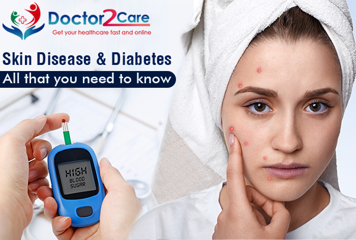Diabetes-Induced Skin Diseases - Treat with the Best Online ...